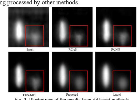 Figure 3 From Content Noise Feature Fusion Neural Network For Image Denoising In Magnetic