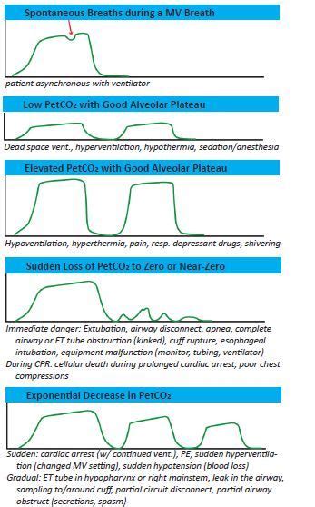 Capnography Abnormal Waveforms Respiratory Care Respiratory