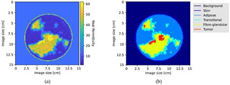 Bioengineering Free Full Text Microwave Breast Sensing Via Deep Learning For Tumor Spatial