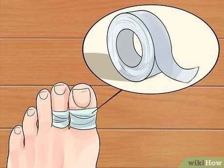 How To Treat Warts On Your Feet 11 Steps With Pictures