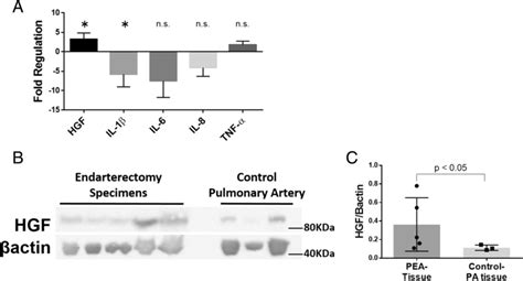 A Pcr Array Analysis Compairing The Mrna Expression Of Hgf And Download Scientific Diagram