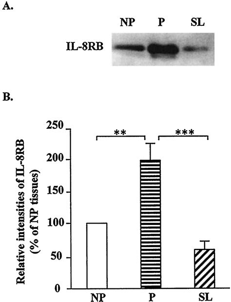 Western Immunodetection Of Il 8 Receptor Type B Expression In The Human