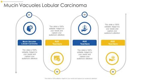 Mucin Vacuoles Lobular Carcinoma Powerpoint Presentation And Slides Ppt Template Slideteam
