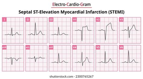 St Elevation Tombstone