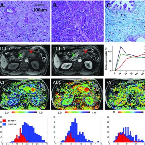 Illustration Of A Diffusion Mri Spin Echo Pulse Sequence In The Upper Download Scientific