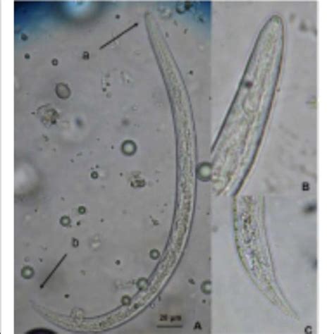 Egg Shell Morphology Of Eucoleus Boehmi And Eucoleus Aerophilus Outer
