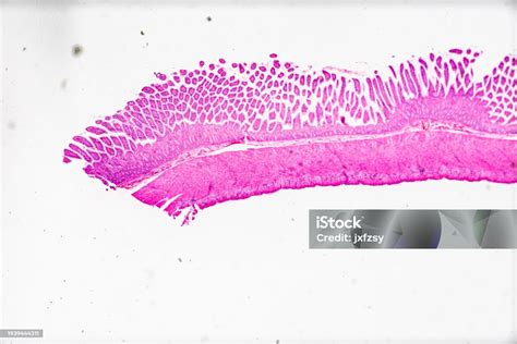 Histology Sample Jejunum Section Under Light Microscopy With White