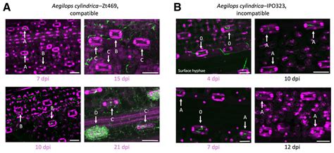 Wild Grass Offers New Genetic Clues To Combat Deadliest Pathogen Of Wheat