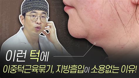 이중턱에는 이중턱근육묶기 지방흡입이 과연 정답일까 Youtube