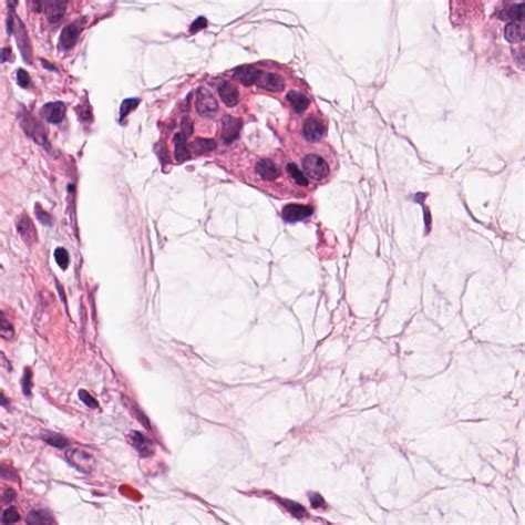 Mitosis Detection Yolo Instance Segmentation Dataset By Mitosis