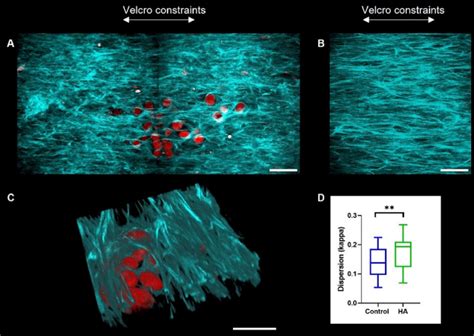 Collagen Organization And Microcalcification Clusters At Day 21 A
