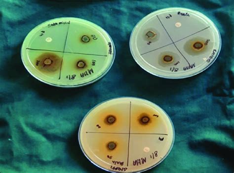 Culture Of Staphylococcus Aureus Enterococcus Faecalis And Download Scientific Diagram