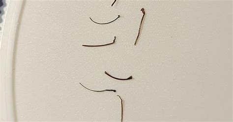 Mutant Hairs From My Face Rpopping