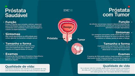 Estagios Do Cancer De Prostata