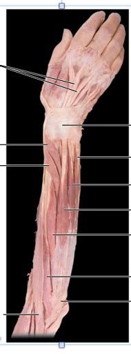 Extensor Pollicis Brevis Cadaver