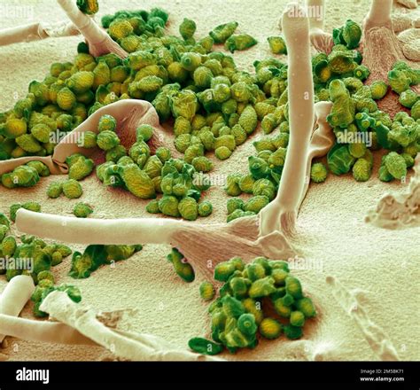 Oral Fungi Coloured Scanning Electron Micrograph Sem Of A Culture From A Used Toothpick The