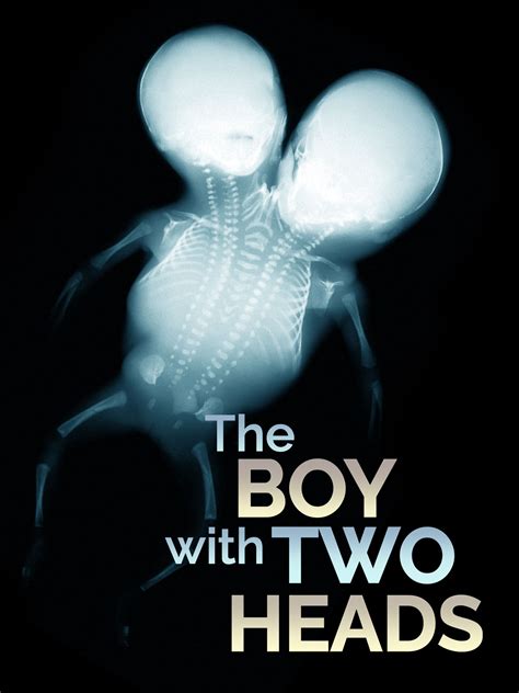 Prime Video The Boy With Two Heads