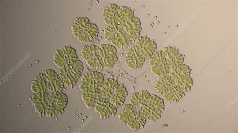Botryococcus Algae Time Lapse Light Microscopy Footage Stock Video Clip K008 4679 Science