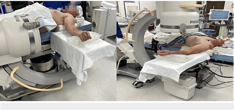 Figure 1 From A Novel Positioning Technique For Olecranon Fracture