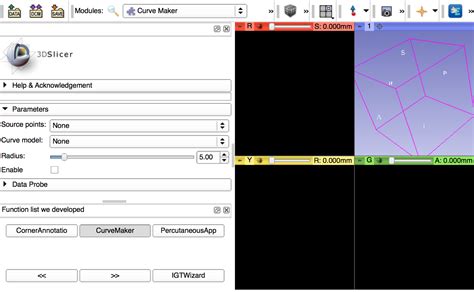 Documentation Modules WorkflowOrganizer Slicer Wiki
