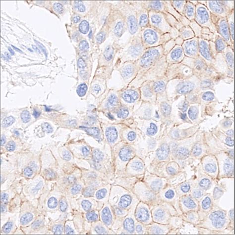 New Rcpath Guidance