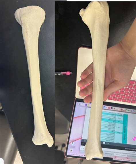 Tibia Diagram Quizlet