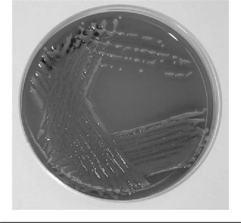 Figure 1 From Mucoid Staphylococcus Aureus Isolated From A Patient With A Suspected Urinary