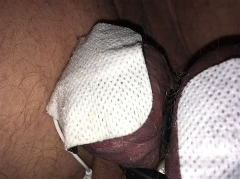 Balls Stretched Split And Estimmed 11 Pics Xhamster