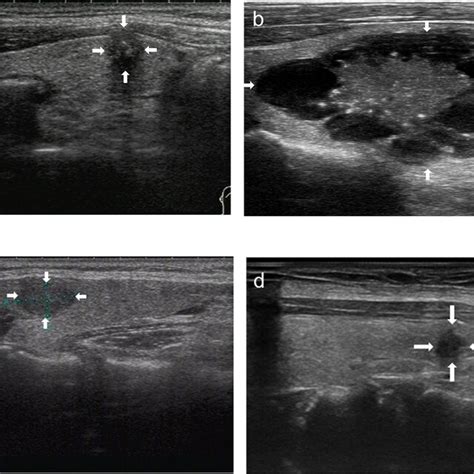 Flowchart Of The Selection Of Patients With 2064 Thyroid Nodules Download Scientific Diagram