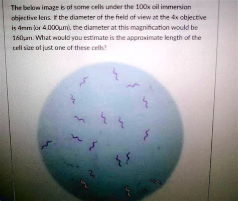 solved the below image is of some cells under the 1oox oil immersion