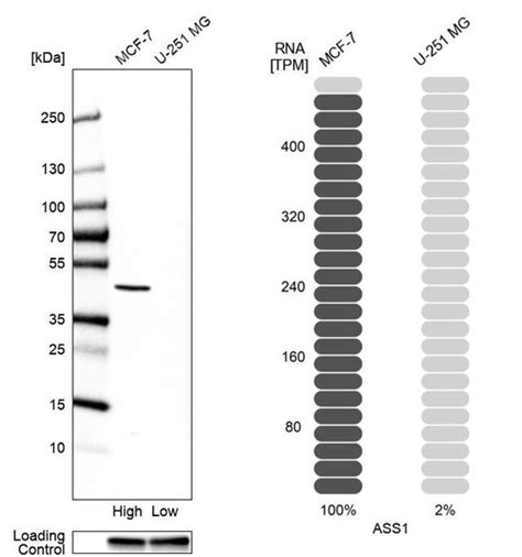 Rabbit Polyclonal Anti Ass1 Antibody Buy For Research Highly