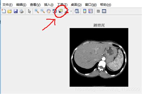 matlab获取图像某点rgb值、灰度值的方法 matlab 获取图像任意点rgb值 csdn博客