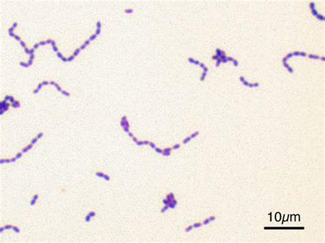 Difference Between Streptococcus And Staphylococcus Definition