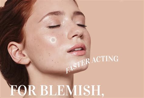 Is Salicylic Pimple Patch Good Alternative Acne Treatment