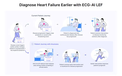 anumana receives fda clearance for ecg ai algorithm to detect low