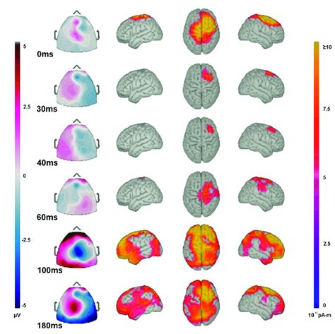 Source Localization Of Tep Activity Butterfly Plot Of Eeg Traces And