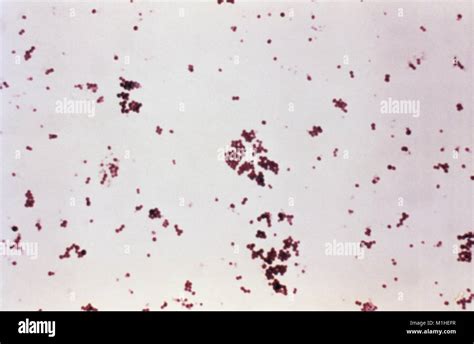 Photomicrograph Of Staphylococcus Aureus Bacteria A Causative Agent Of