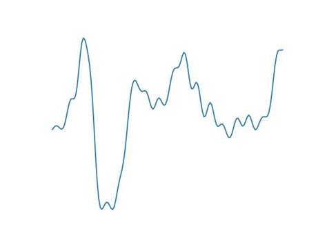 Ecg Object Detection Model By Ecg