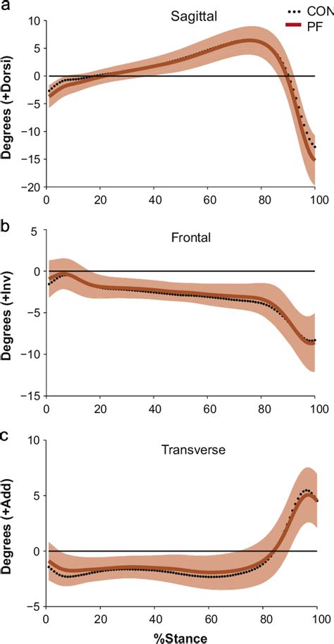 Figure 3 From Multi Segment Foot Kinematics And Ground Reaction Forces During Gait Of