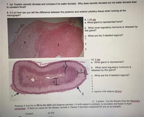 Solved 7 1pt Explain Osmotic Diuresis And Compare It To