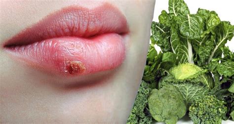 7 Dangerous Yet Often Neglected Signs Of Folate Deficiency