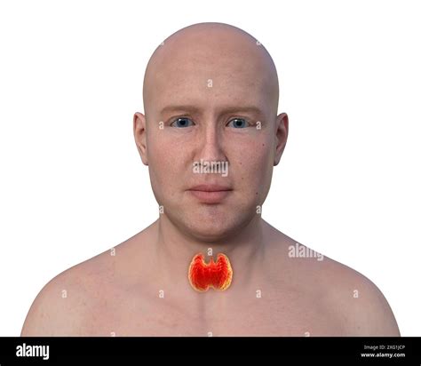 Illustration Of A Mans Head Neck And Shoulders With The Thyroid Gland Highlighted The Thyroid