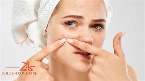 معرفی انواع راه های از بین بردن جوش صورت در یک روز