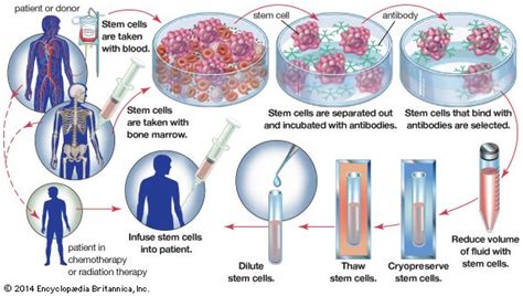 Bone Marrow Transplant Medicine