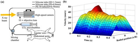 Schematic Of The Rat Extracorporeal Loop System With A Microbubble Download Scientific Diagram
