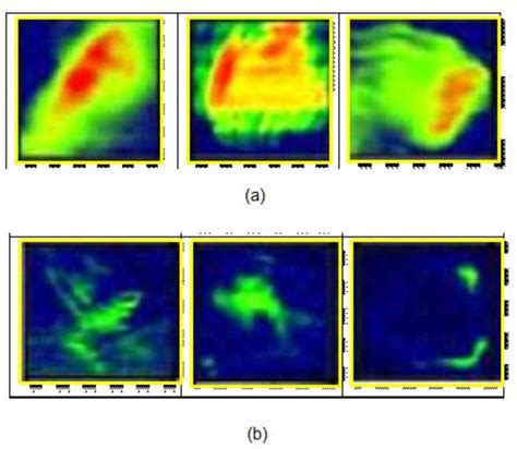 Figure 1 From Detection And Classification Of Breast Cancer Based On Terahertz Imaging Technique