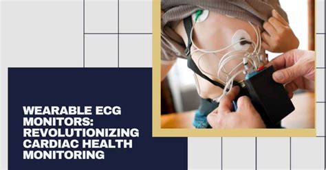 Revolutionizing Cardiac Health Monitoring