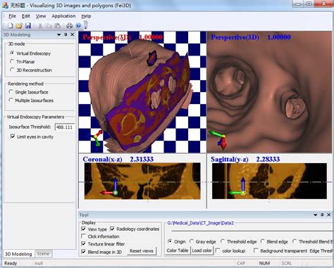 3d Processing And Visualization System For Volume And Mesh Combined Scenes