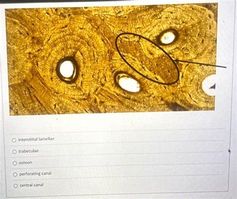 Solved Interstitial Lamellae Trabeculae Osteon Perforating