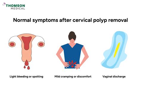 Cervical Polyps Causes Symptoms Treatment Cervical Polyps 650x442